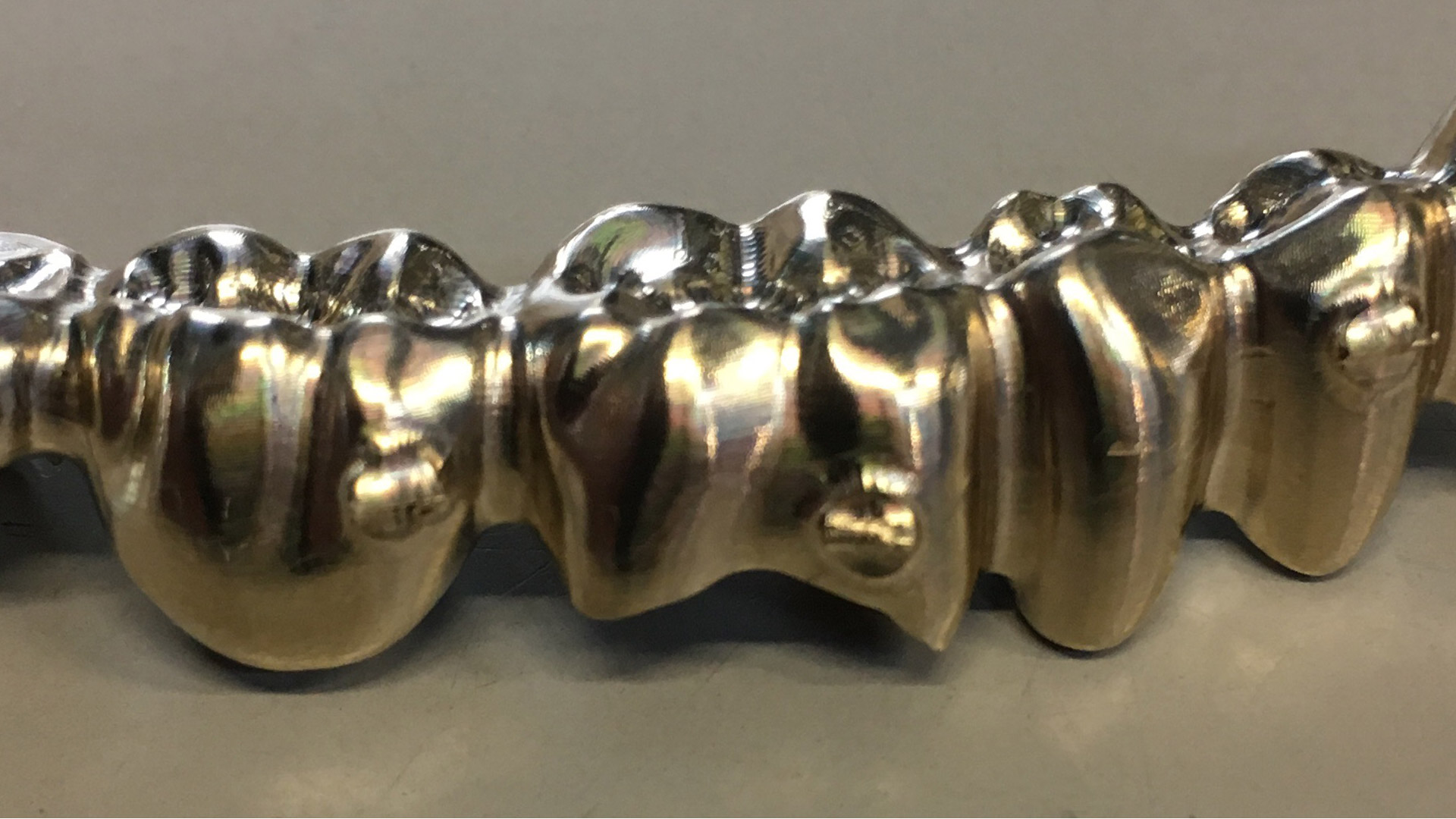 Milled gold dental restorations | Strategy Milling