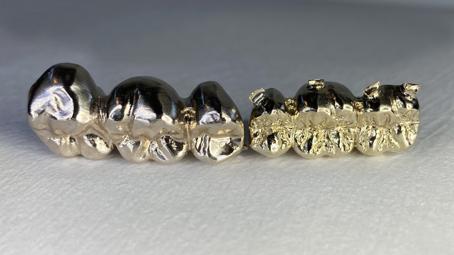 Milled gold dental restorations | Strategy Milling