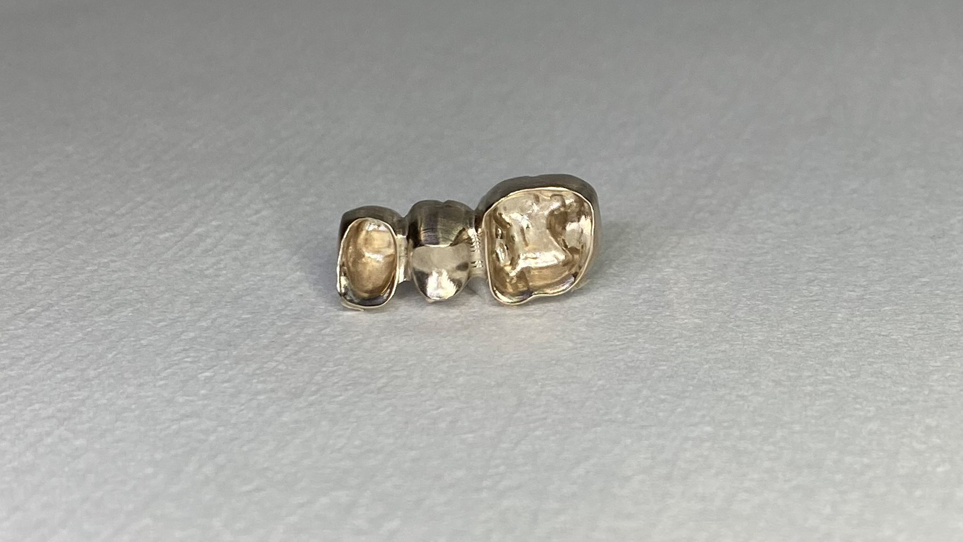 Milled gold dental restorations | Strategy Milling